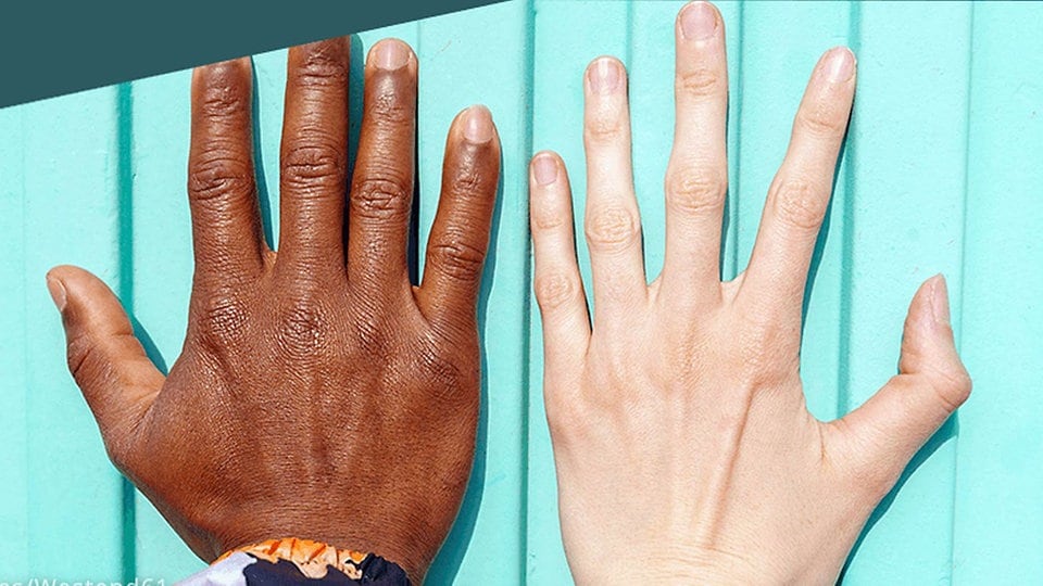 ️ Stimmt: Hautfarbe beeinflusst Mitgefühl | MDR.DE